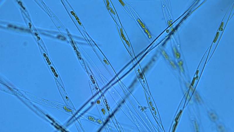 New Way To Track Toxic Algae Threatening Shellfish Industries Developed ...